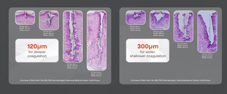 eCO2 - Cynosure Lutronic EMEA eCO2 Plus™ Laser | Cynosure Lutronic